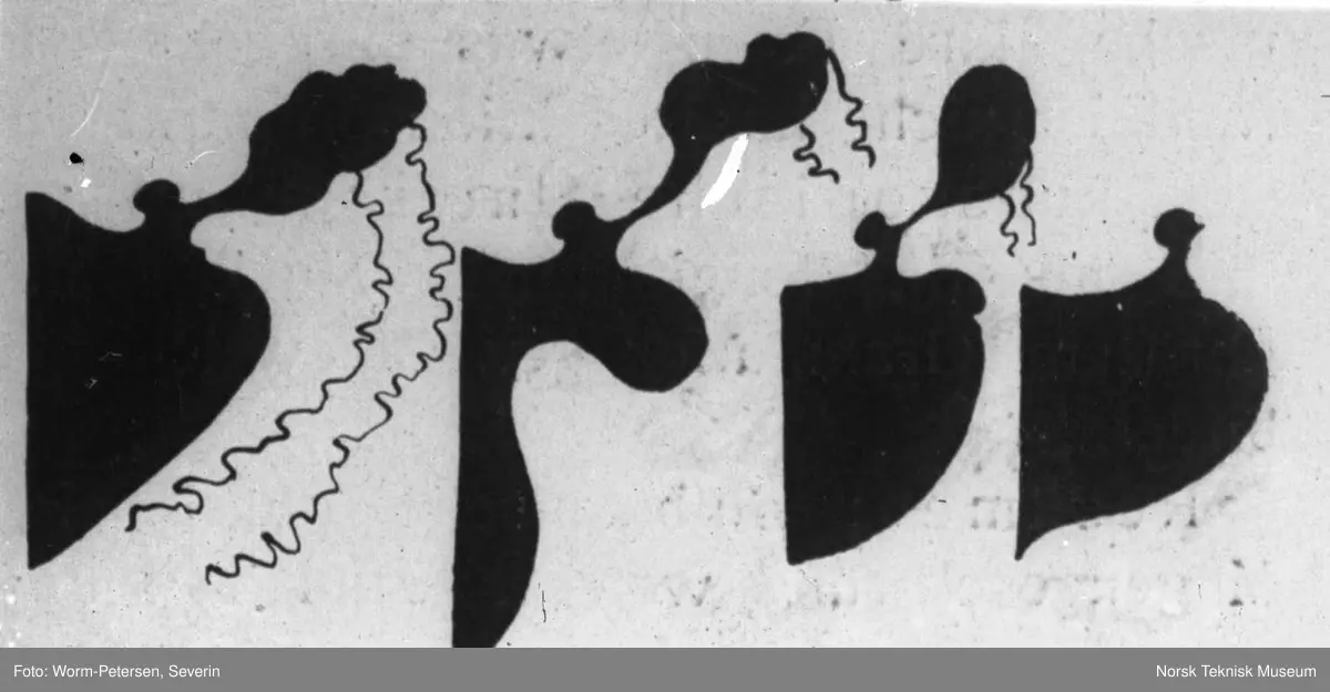 Illustrasjon, svulst (basert på røntgenbilde) - Norsk Teknisk Museum ...