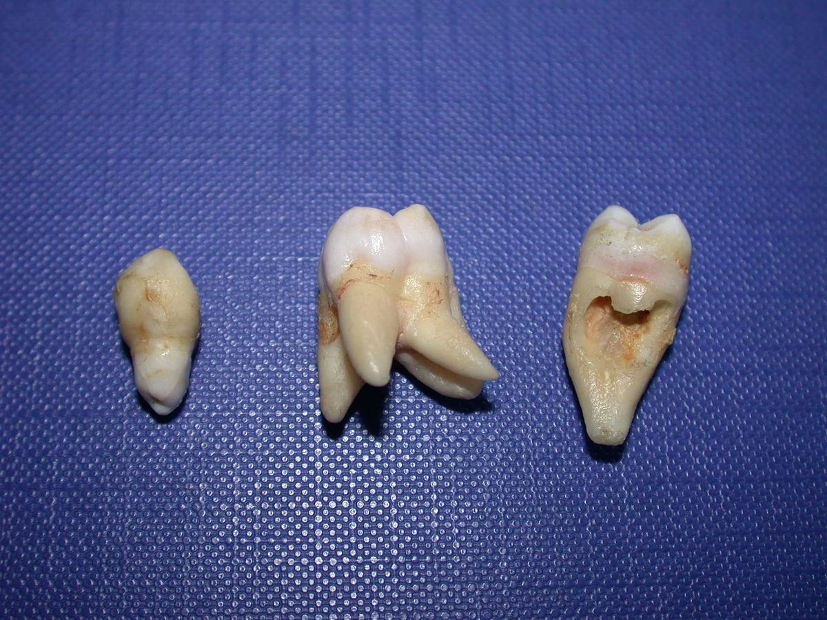 Tenner - Borgarsyssel Museum / DigitaltMuseum